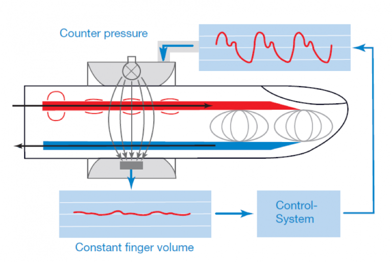NON INVASIVE CARDIAC OUTPUT MONITORING, A CLINICAL EXAMPLE | LiDCO ... NON INVASIVE CARDIAC OUTPUT MONITORING, A CLINICAL EXAMPLE | LiDCO ...